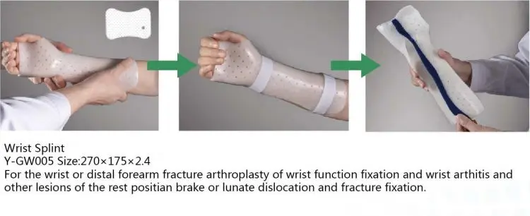 Eco Polymer Splinting Material - Thermoplastic Polyurethane
