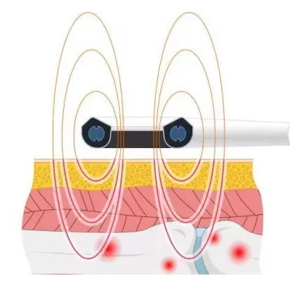 Portable Magnetotherapy Pemf Magnetic Therapy Physio Magneto Device Red ...