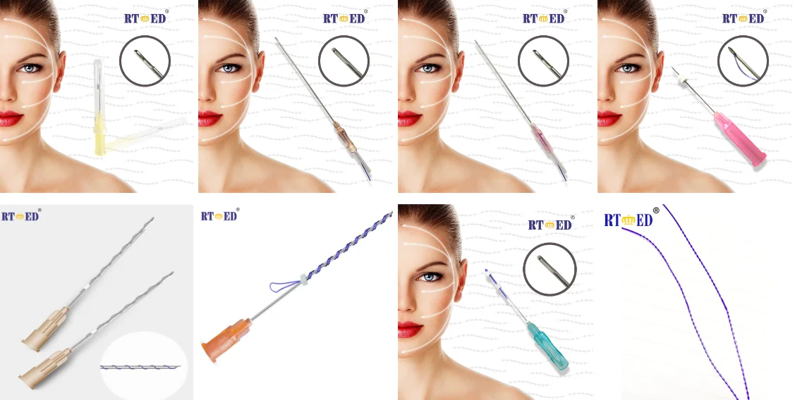 PDO/PLLA/PCL Thread Lifting for Face Lifting & Tightening