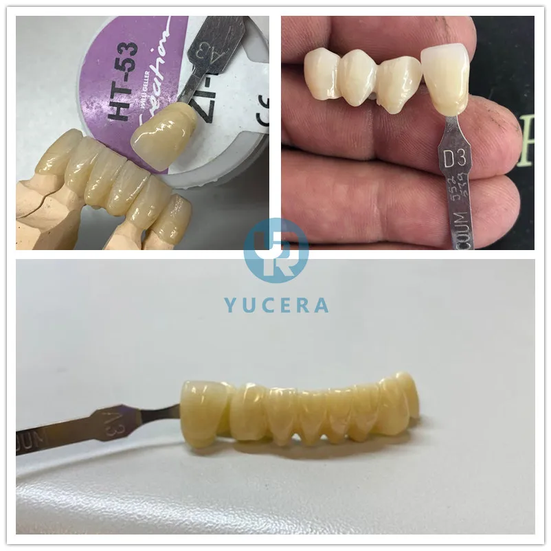 Yucera 3D Multilayer Zirconium Block - Dental CAD CAM Material