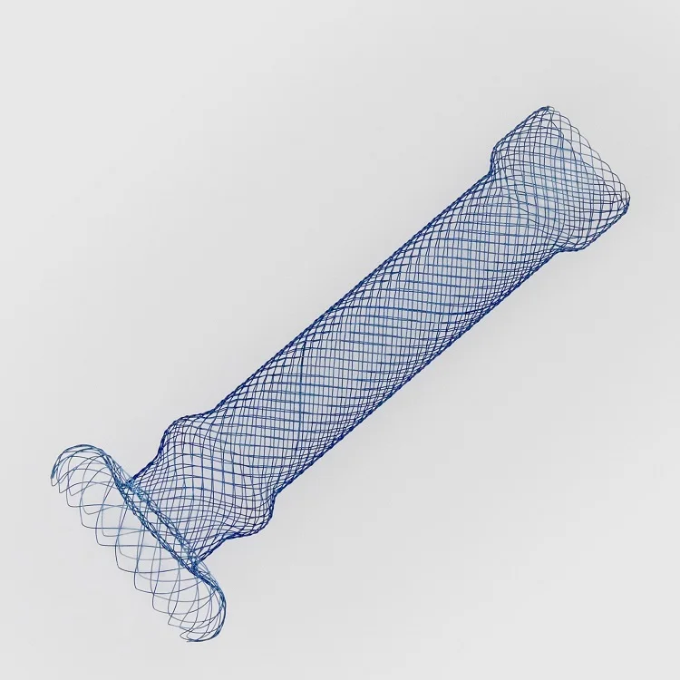 Ni-ti Wire Fistula-occluding Metallic Uncovered Cardia Umbrella ...