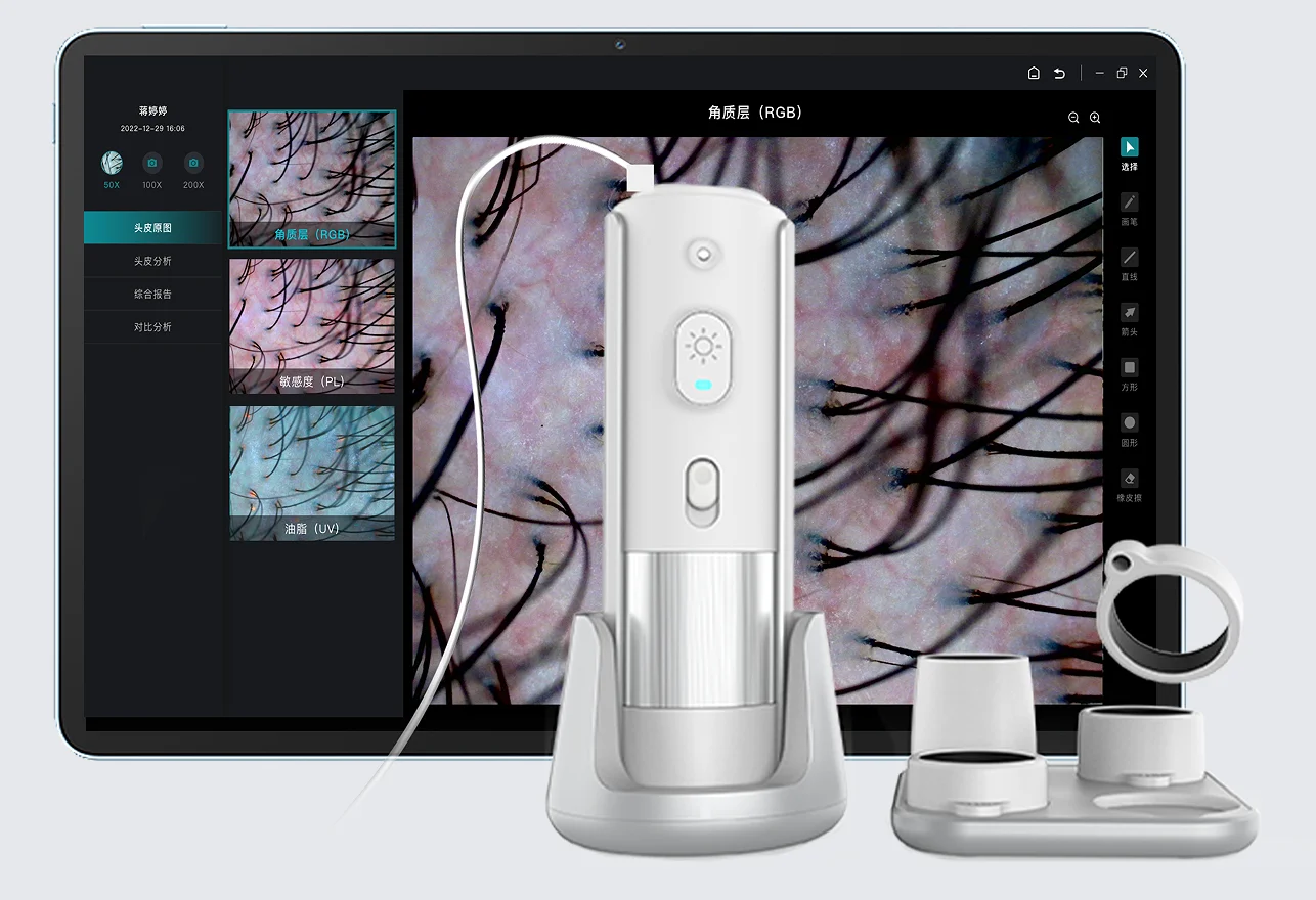 Digital Scalp Analyzer Device Hair Follicle Detector Intelligent AI ...