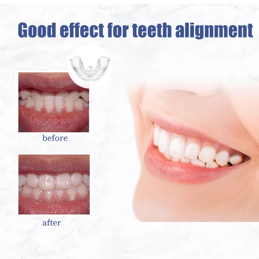 Teeth Straightening Trainer 3 Stages Suitable Alignment Different Tooth ...