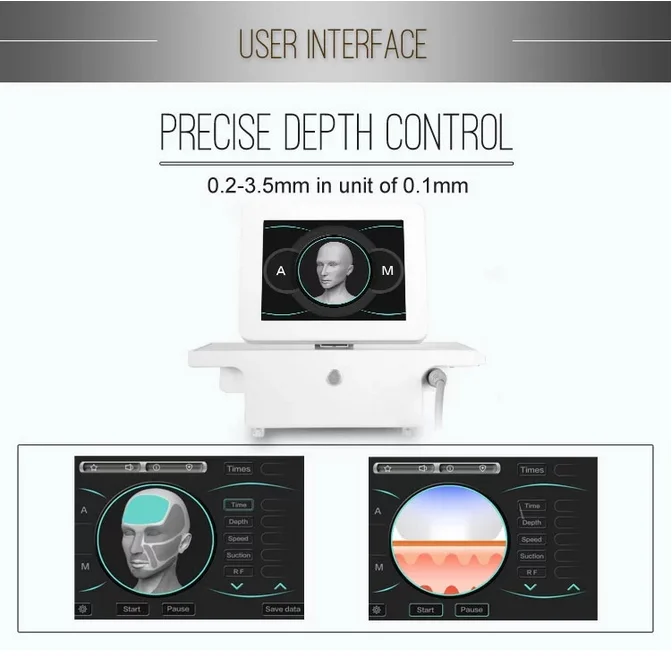 Portable Gold Micro Needle Machine With Radio Frequency Skin Tightening ...