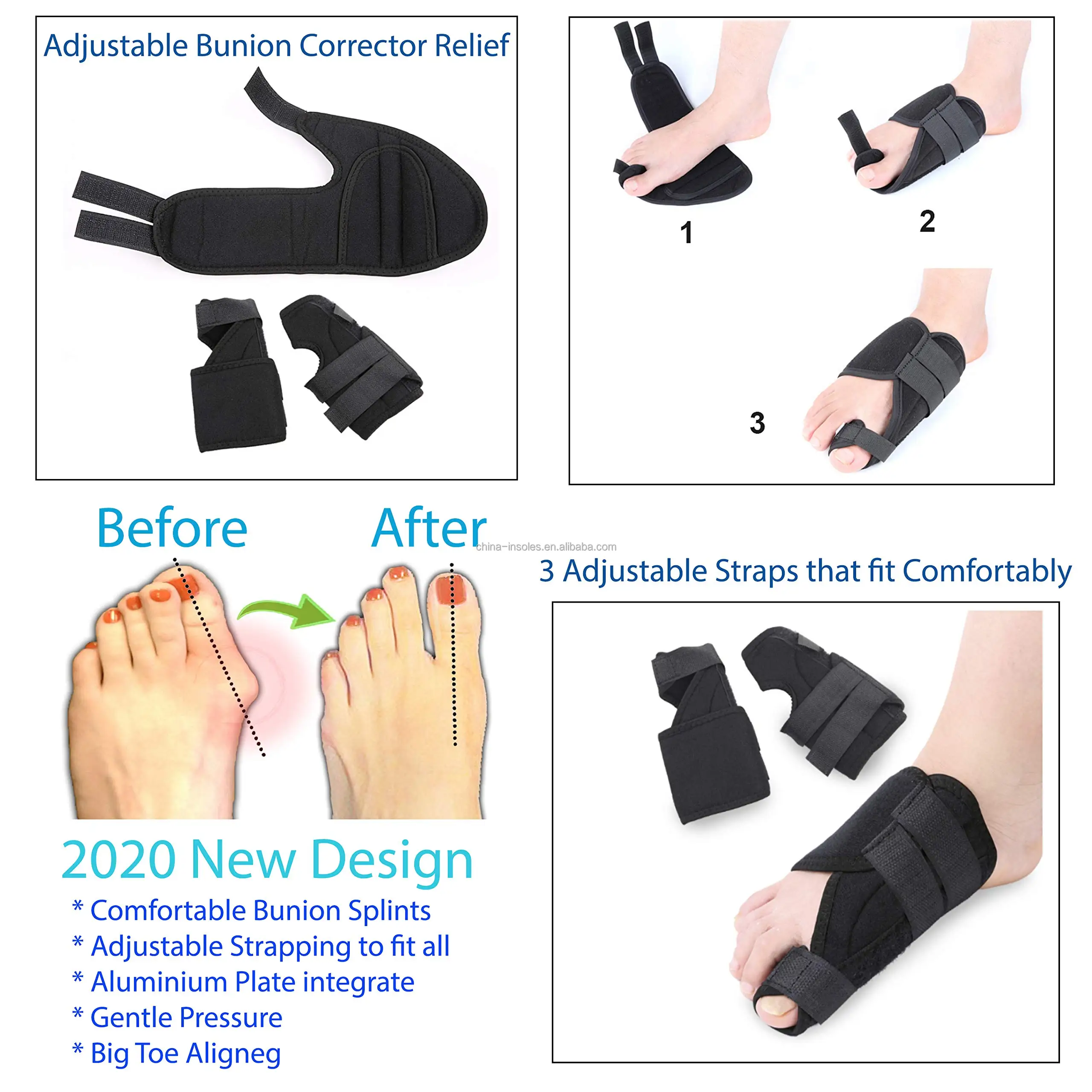 Bunion Corrector Kit - Hallux Valgus Pain Relief Solutions