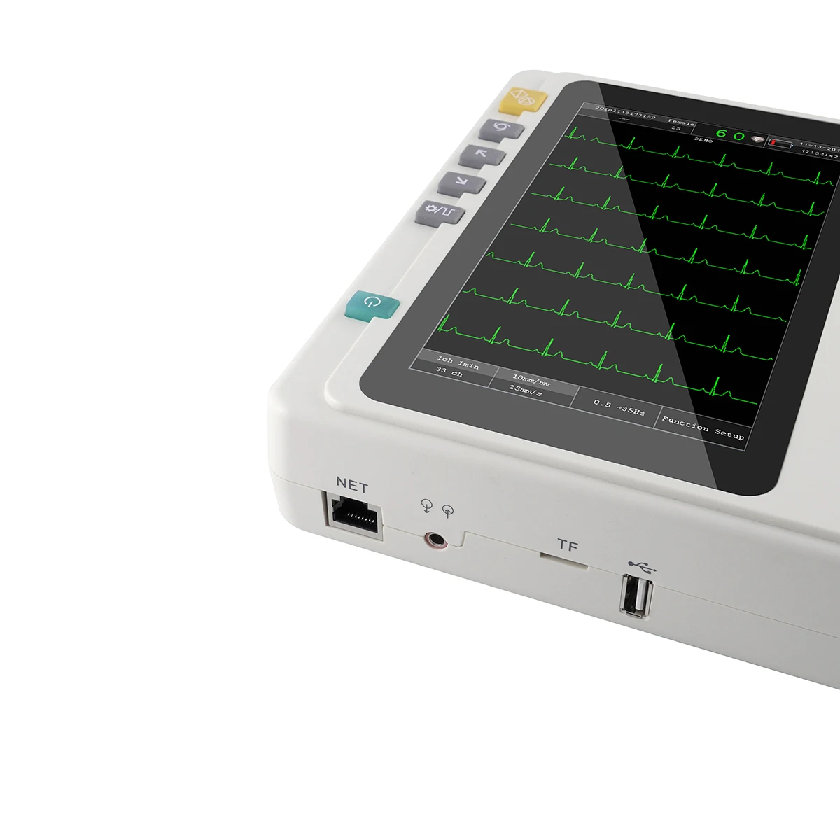 2024 Hot-Sell ECG Machine - Portable 12-Leads EKG Device
