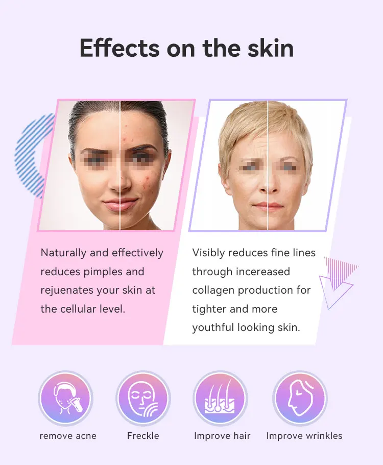 Portable 5 In 1 High Frequency Skin Therapy Wand Facial Machine ...