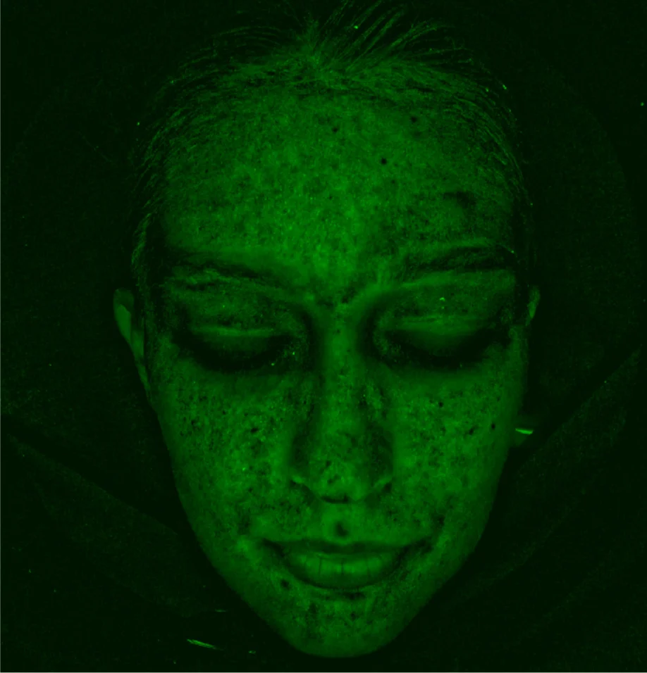 MEICET MC10 Skin Analyzer - Professional Facial Care Tool