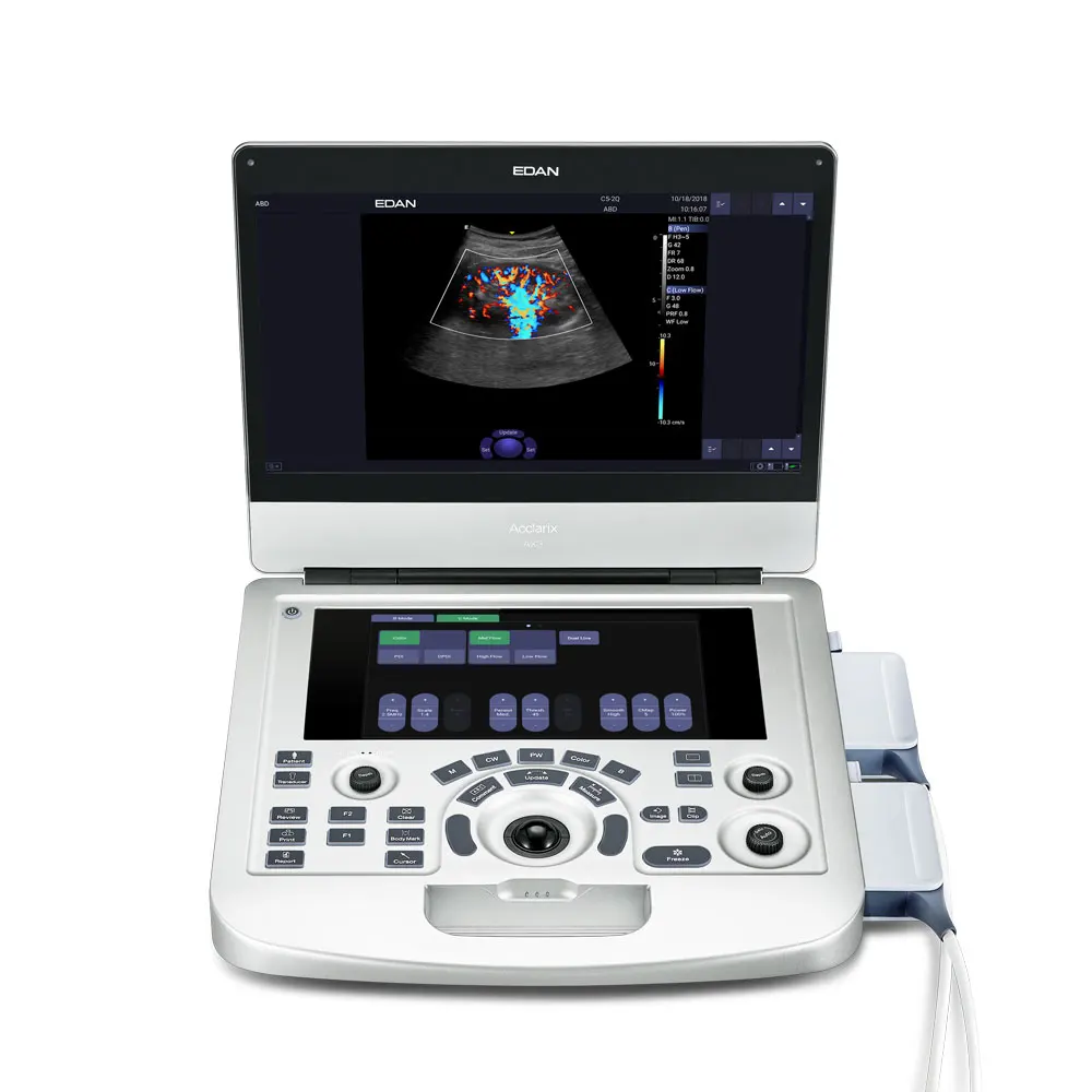 Edan Acclarix Ax3 Ax8 Echocardiography Ultrasound Machine Price For ...