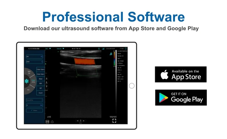 Small Size Handheld Doppler Ultrasound Scanner - 3 in 1