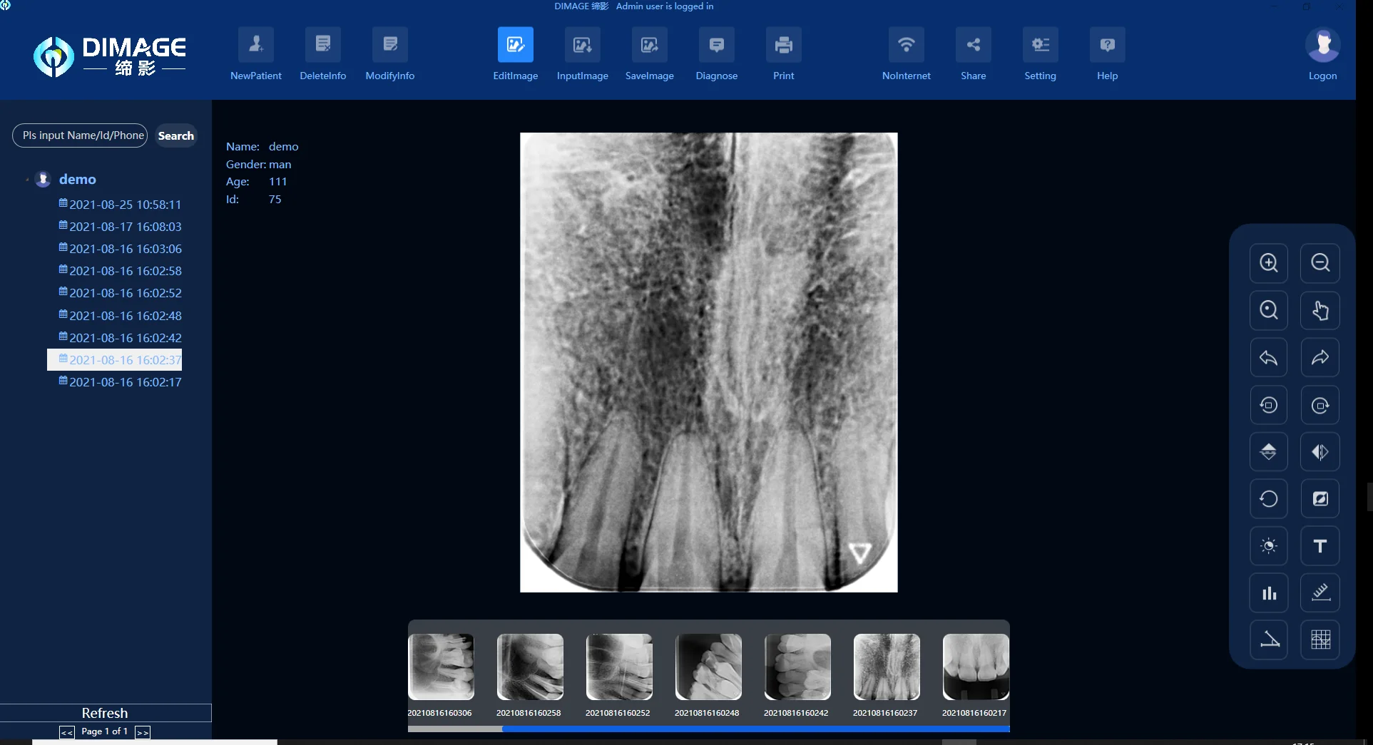 Dental Imaging Plate Scanner/phosphor Plate Scanner/x Ray Scanner - Buy ...