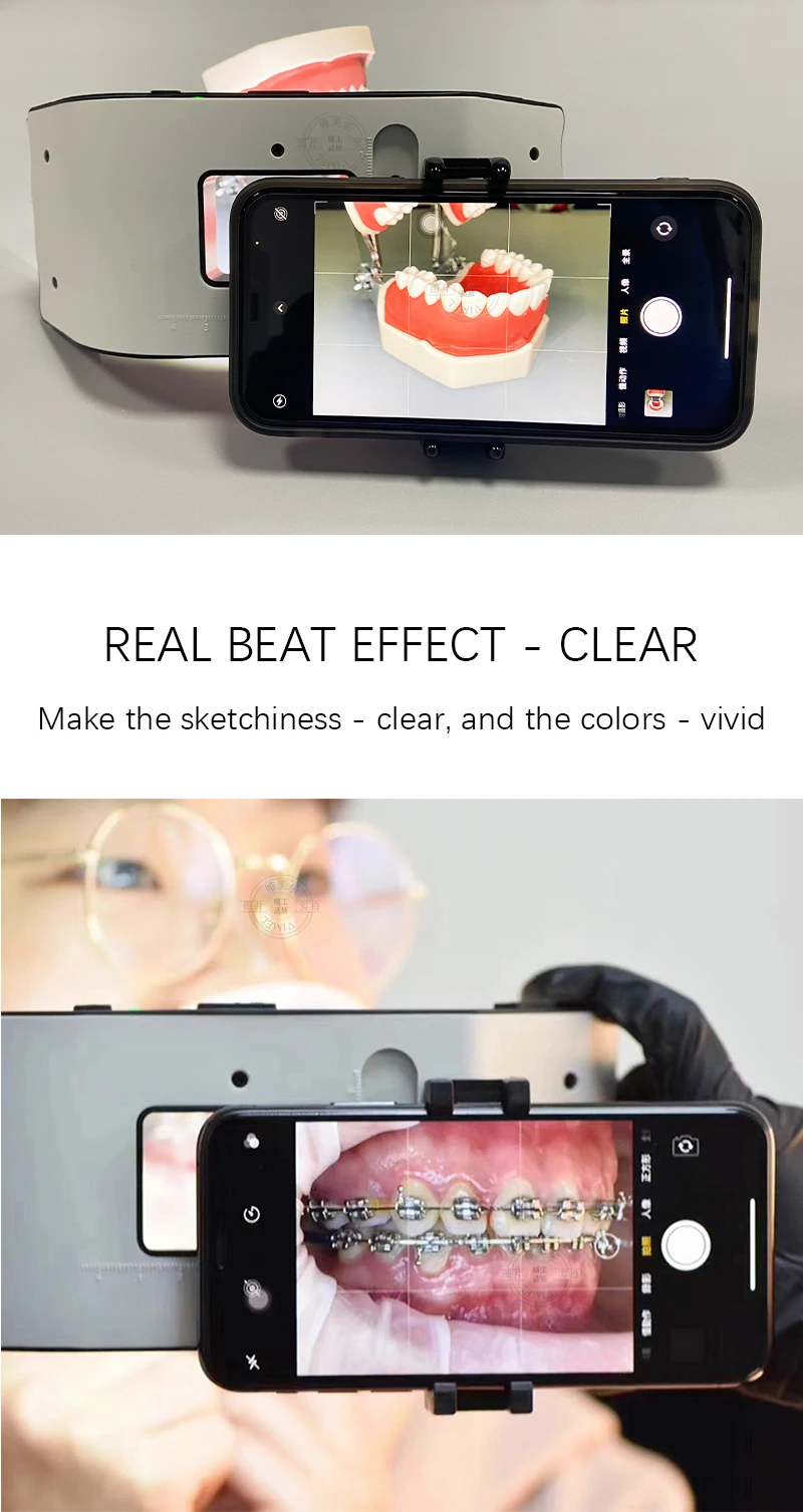 Intraoral Dental Photography Light LED Dental Oral Filling Lamp for ...