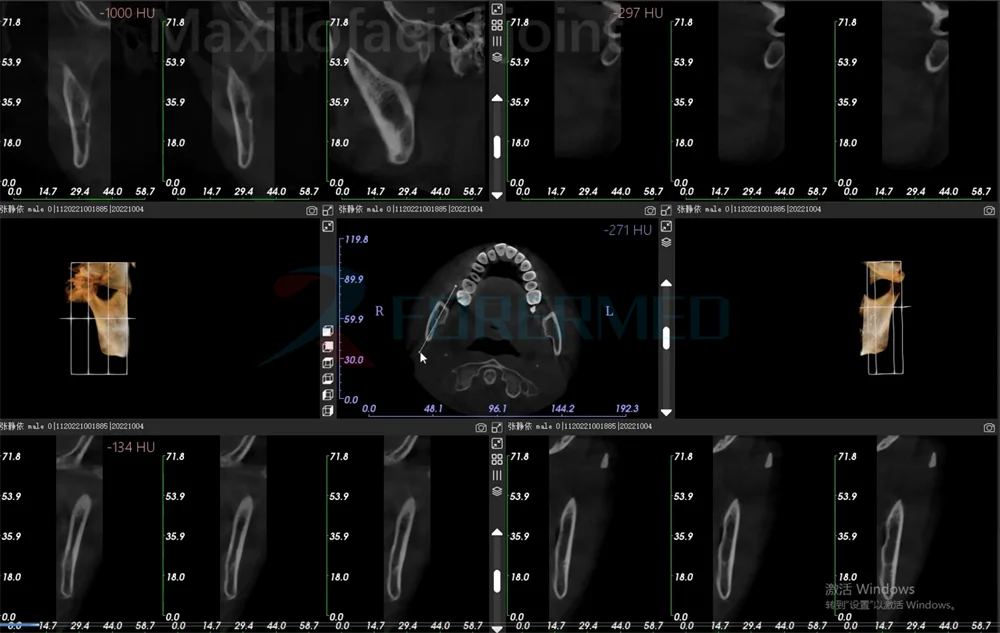 4 In 1 Digital Cbct Dental X Ray M2 Fov Cone Beam Ai Computed ...
