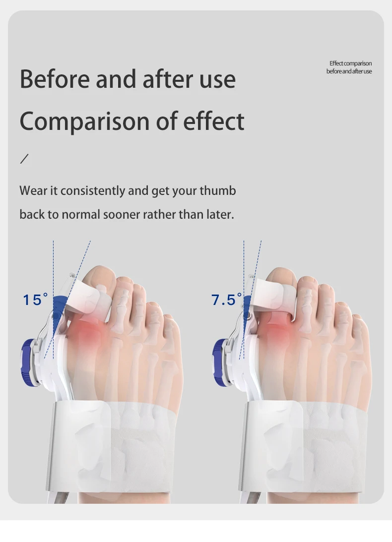 Tech Love Blue Adjustable Big Toe Splint Foot Bone Protrusion Toe ...