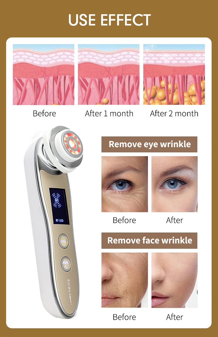 Rf Radio Frequency Facial Lifting Vibration Face Massage Ems Anti ...