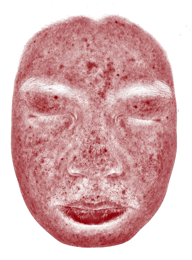 AIMYSKIN 3D Facial Skin Analysis Machine - Intelligent Scanner