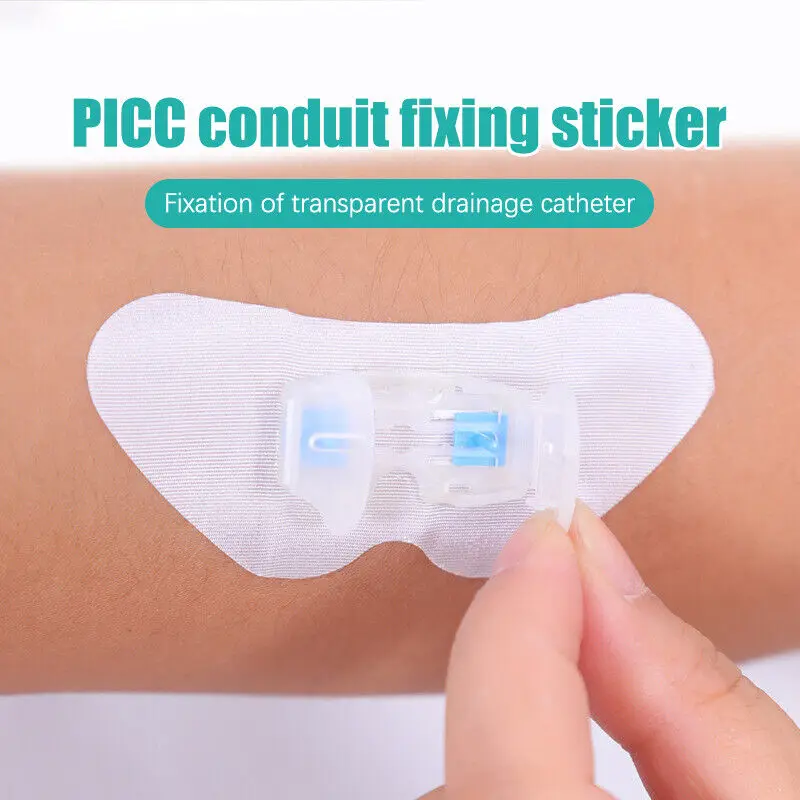 3 cm X 9 cm Sterile PICC Line/Catheter Fixing Device/Paste| Alibaba.com