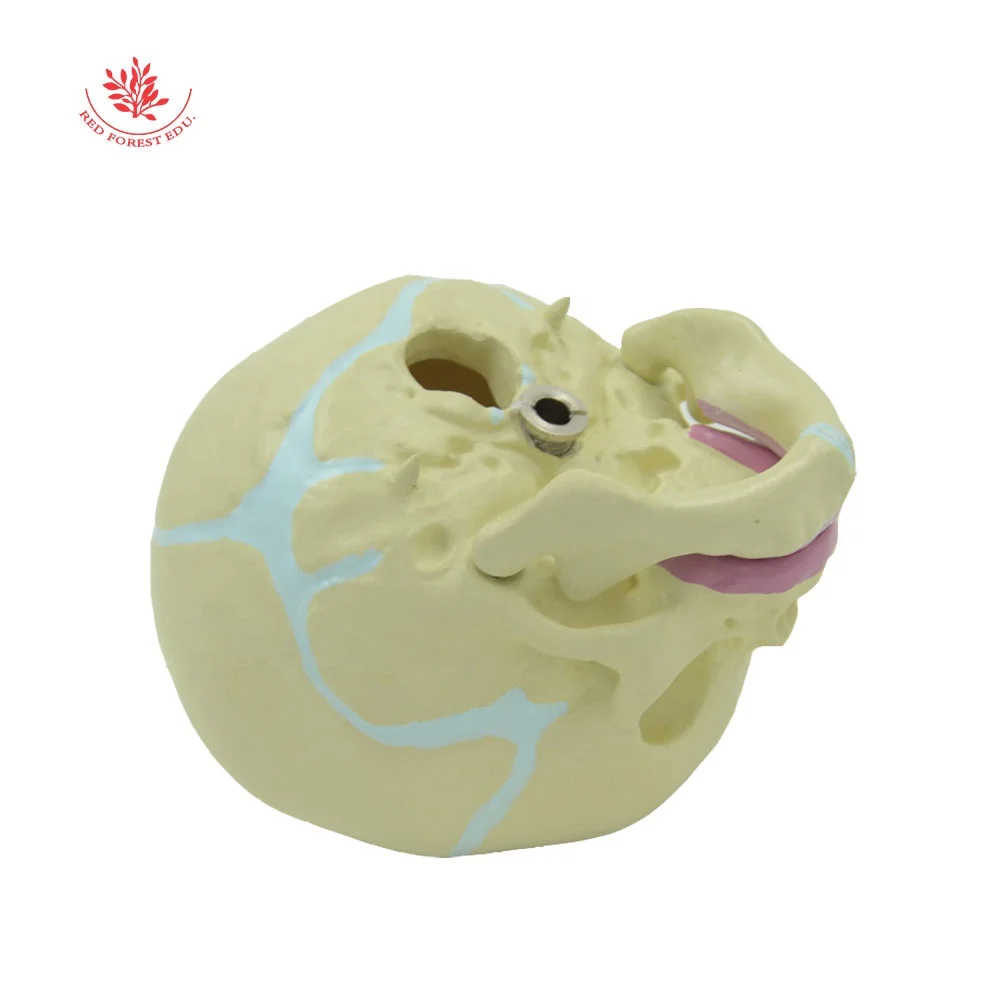 Anatomical Skull Model Fetal Skull Model Clinical Pregnancy Baby Skull ...
