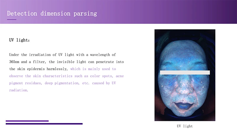 Professional Facial 3D Skin Analyzer Facial Scanner for Dermatology ...