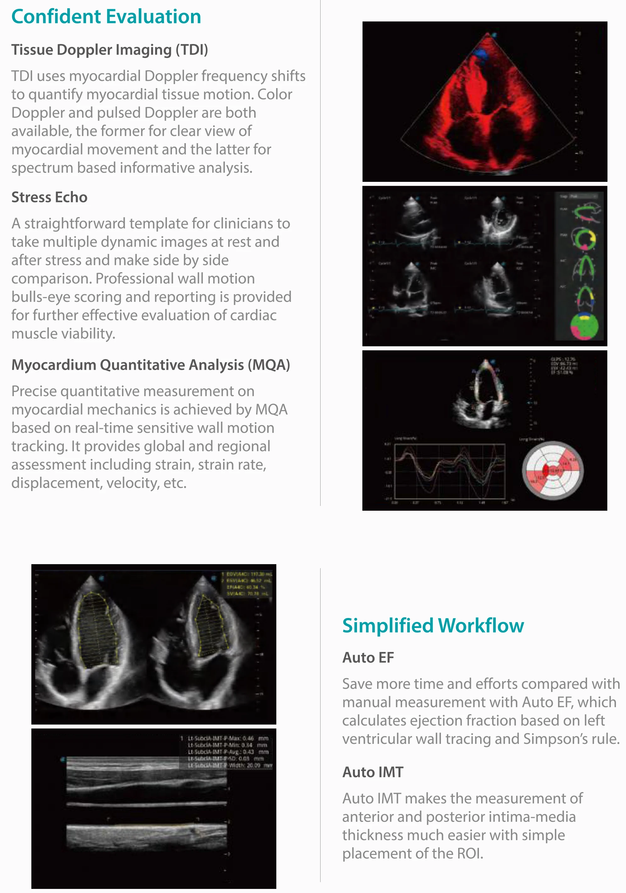 Sonoscape P50 Elite Trolley Color Doppler Ultrasound Machine