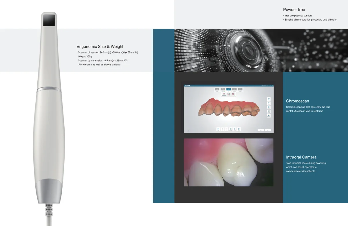Cost Effective Dental Intraoral 3d Scanner Fussen S6000 - Buy Intraoral ...