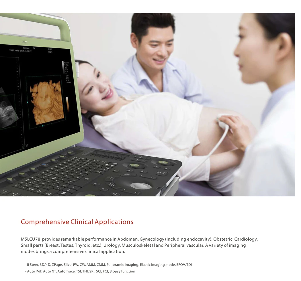 Medsinglong Color Doppler Ultrasound Machine - 4D Scanner