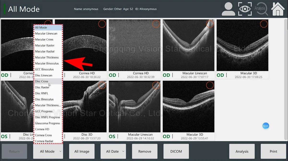 Retiview-500 OCT Machine for Eye Exams - 1 Year Warranty