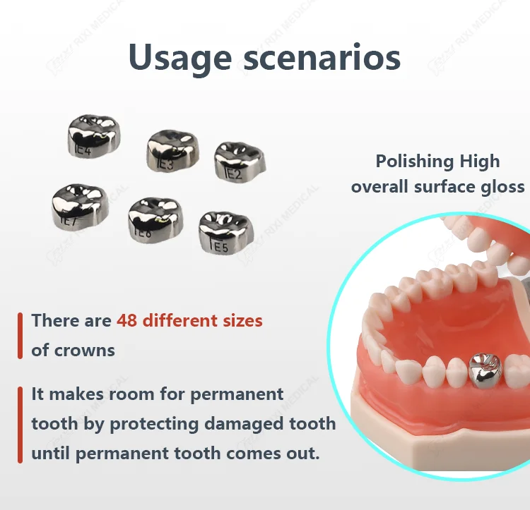 Dental Kid Crowns Preformed Metal Crown Stainless Steel Temporary ...