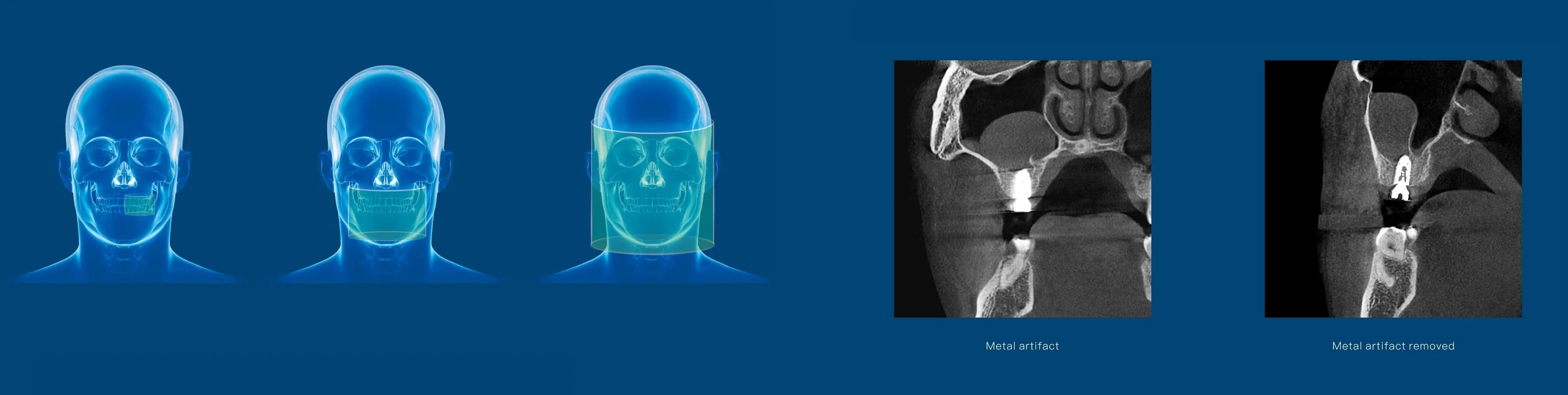 4 In 1 Digital Cbct Dental X Ray M2 Fov Cone Beam Ai Computed ...