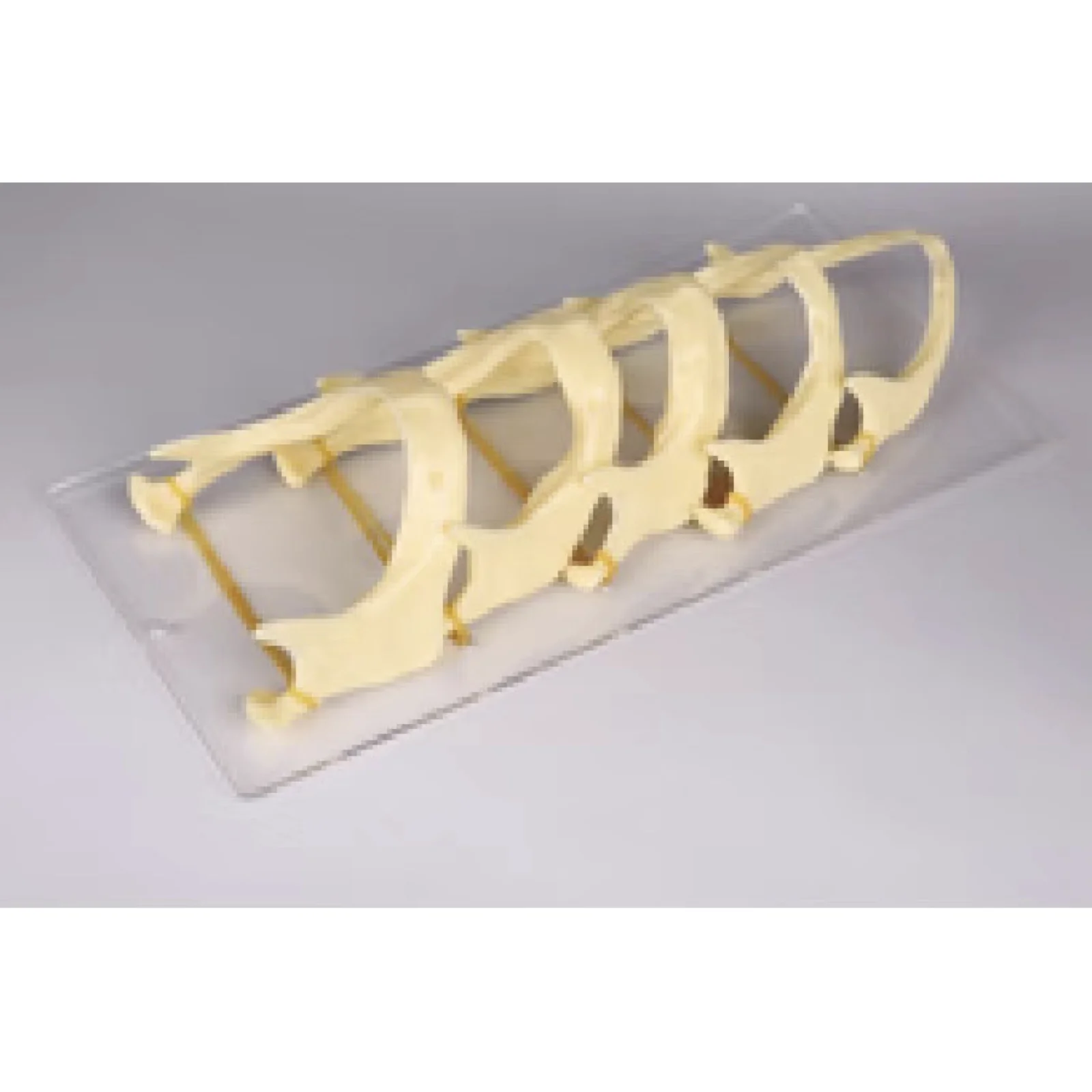 Kyrenmed Atrophied-ridge Mandibular Ble Model Set Of 5 The Development ...