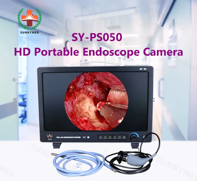 SY-PS050 Integrated Endoscopy System - HD Imaging & Diagnostics
