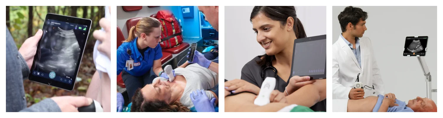 Small Size Handheld Doppler Ultrasound Scanner - 3 in 1