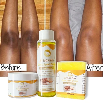 Wholesale Oem Dark Knees Knuckles Elbows Armpit Whitening Bleaching ...