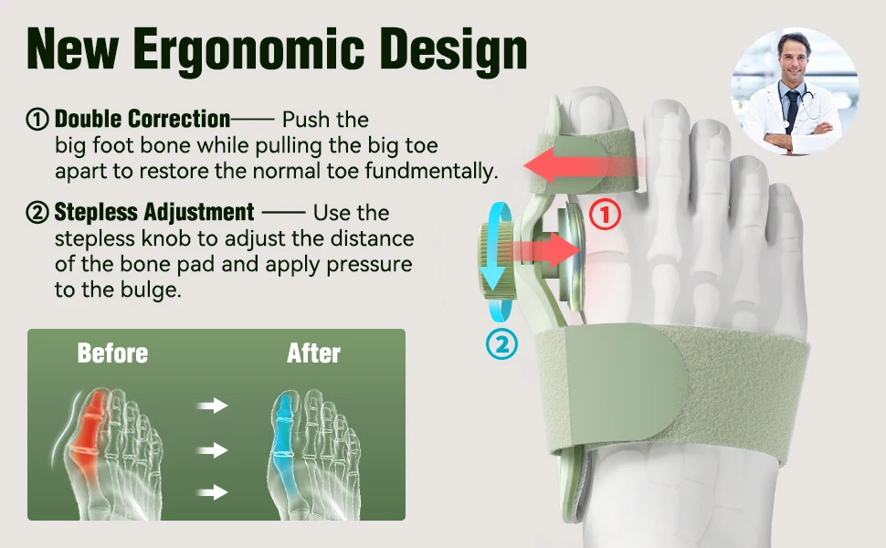 Adjustable Bunion Corrector - Orthopedic Toe Separators
