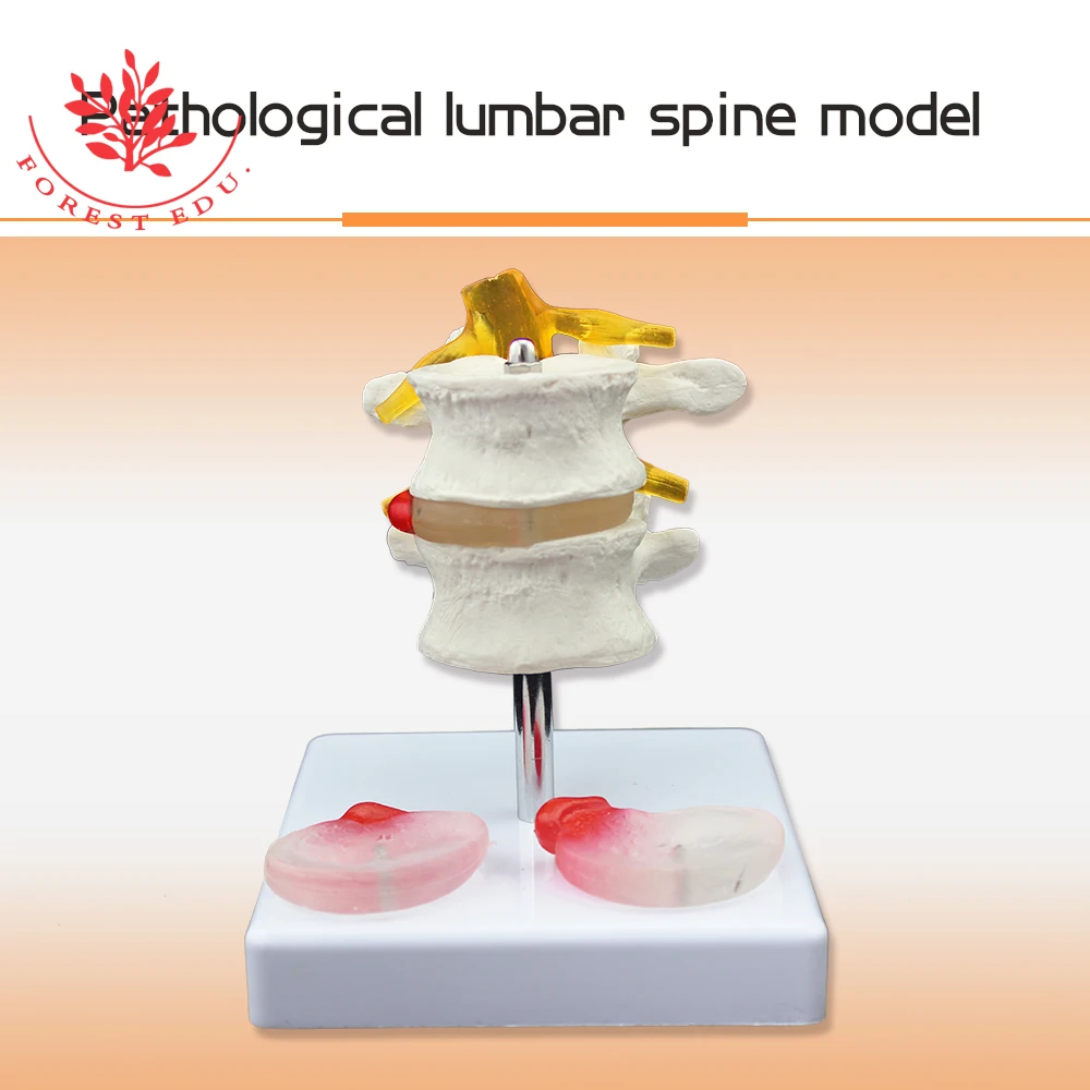Spine Model Lumbar PVC Material Life Size Lumbar Vertebrae Spine ...