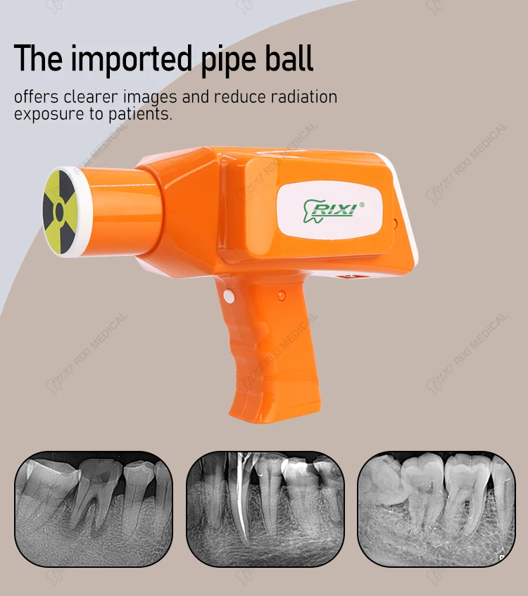 Intraoral Dental X-ray Radiographic Digital Sensor Portable X-ray ...
