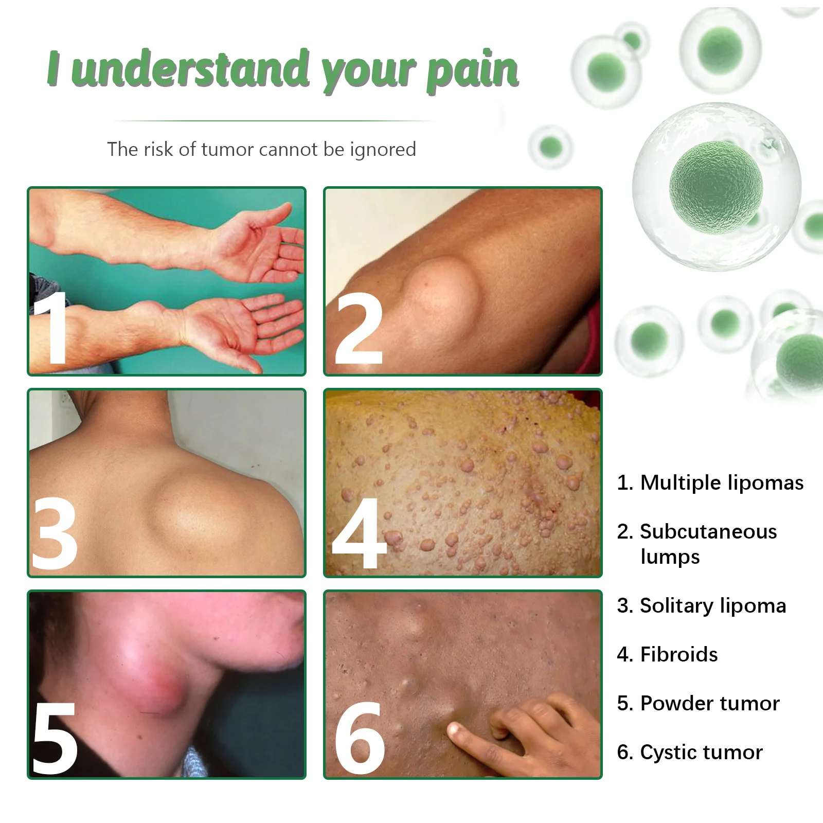 Effective Anti Swelling Lipoma Removal Patch Organic Lymphatic Drainage ...