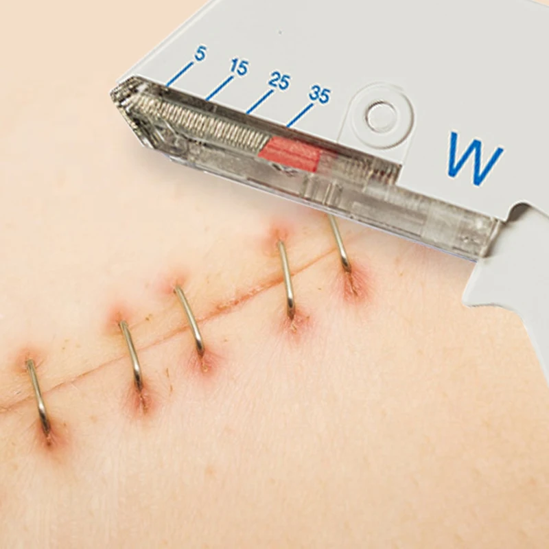 Medical Surgical Wound Closure Sterile 35w Sterile Surgical Staple ...