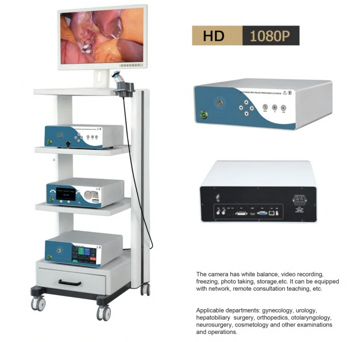 Endoscopy Camera System - 4K UHD Laparoscopic Equipments