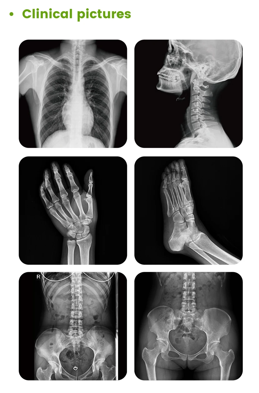 Digital Radiography System 32kw Single-phase 110V Advanced Double ...