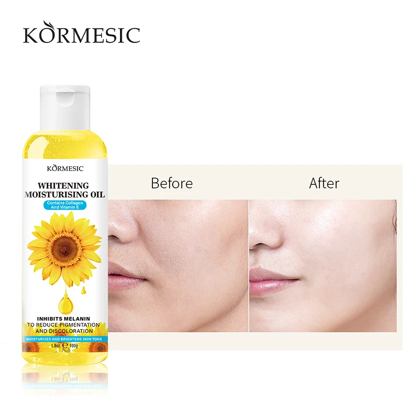 Kormesic Whitening Natural Moisturize Massage Body Oil Whitening And ...
