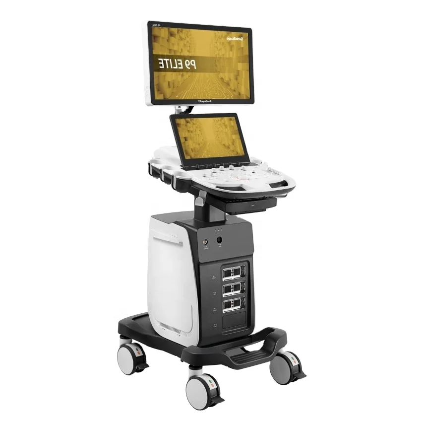 Scanner Trolley Echografo Ultrasound Machine/sonoscape P9 Elite 5d ...