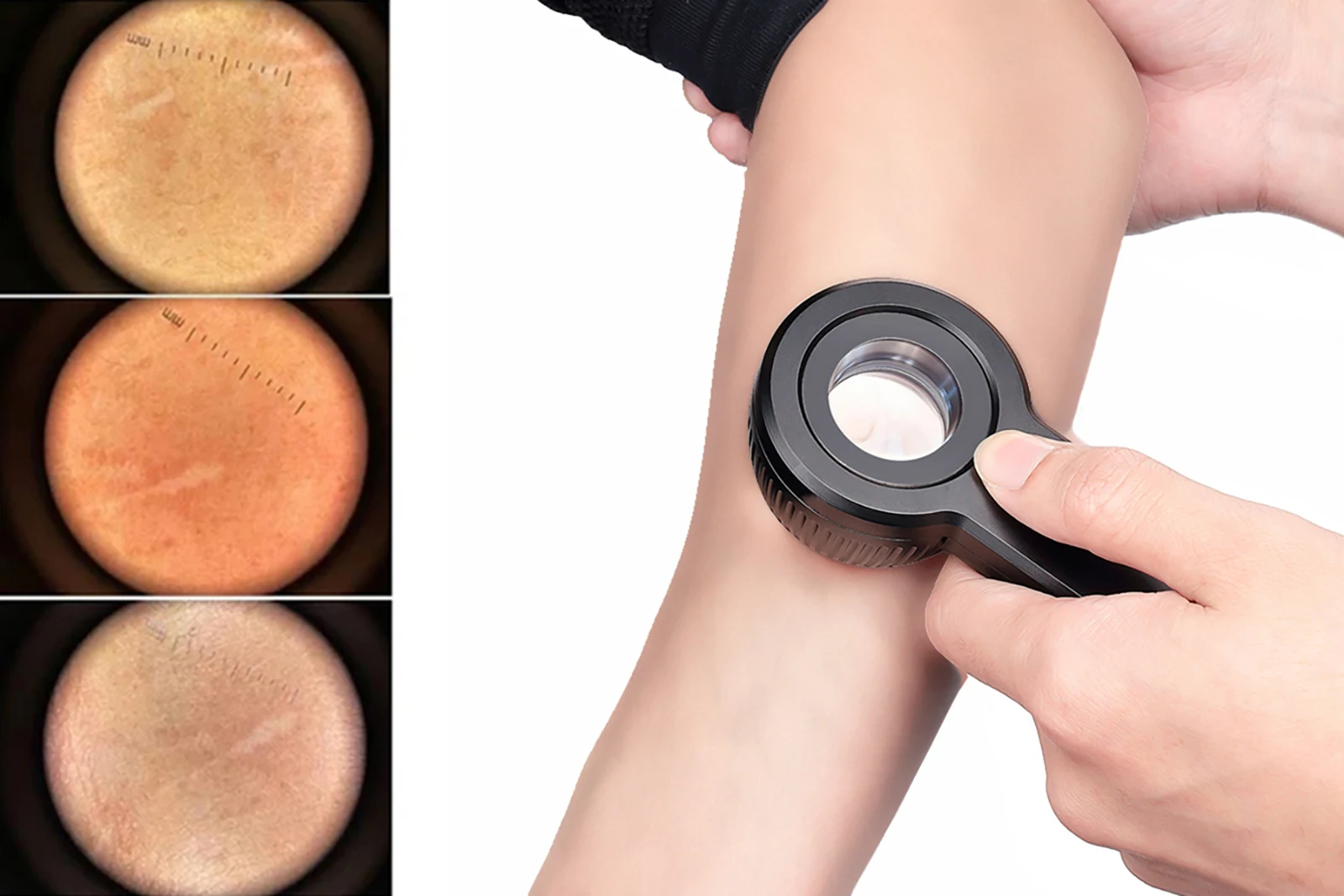 High Quality Rechargeable LED Illumination Dermatoscope, DE-3100 for ...