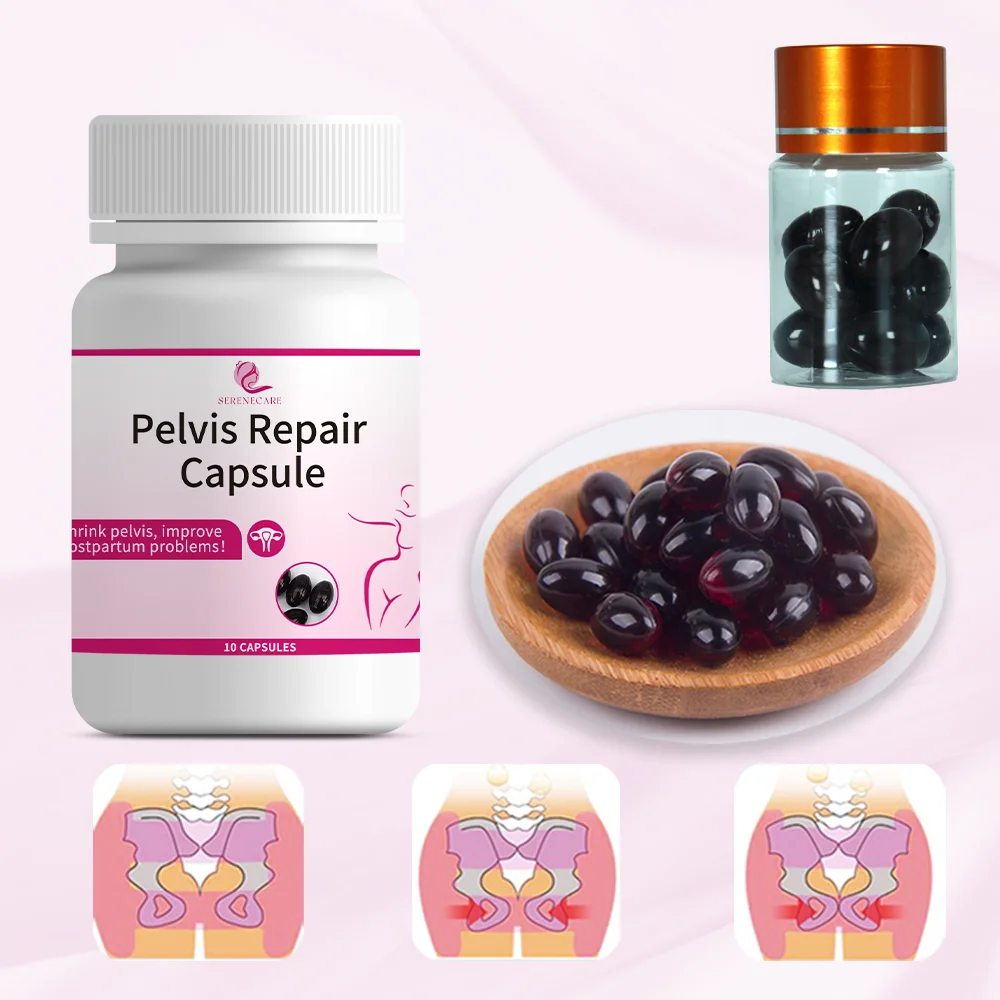 Gynecological Private Care Pelvis Narrowing Closure Capsule Pelvis ...