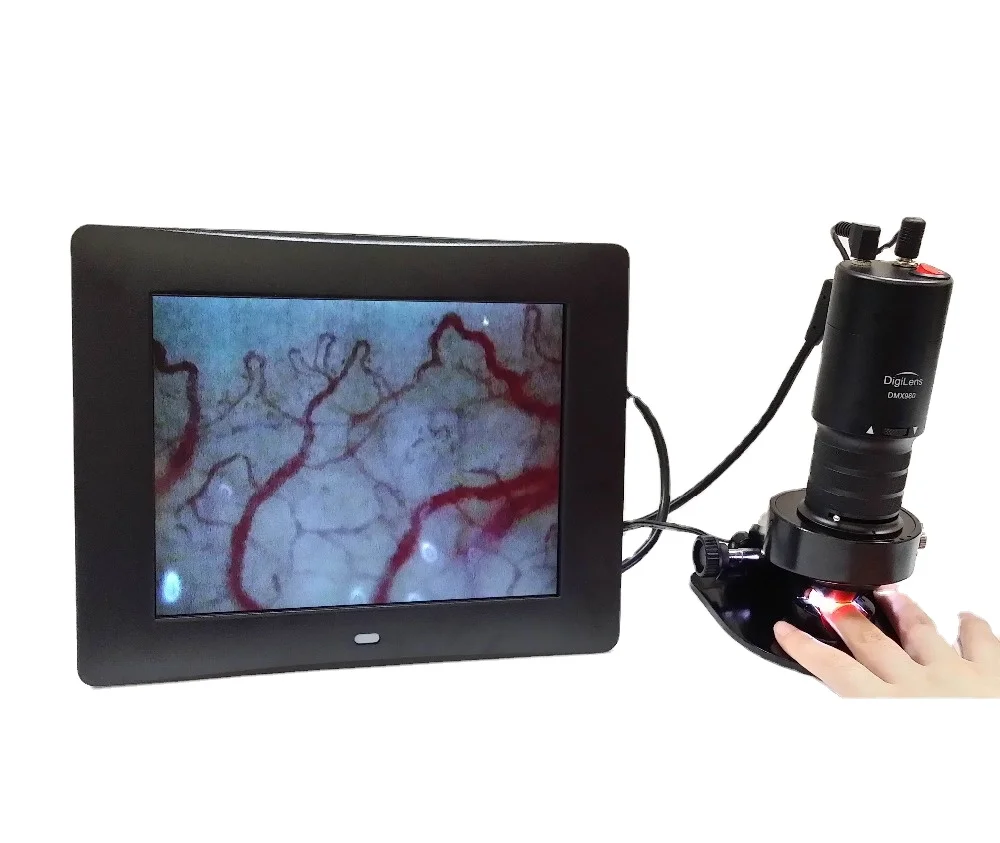 DMX980 Microscope microcirculation Microvascular capillary microscope ...