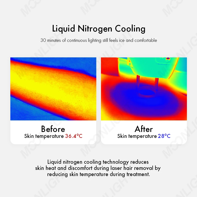 Best Alexandrite Crystal Laser Rod Hair Removal Machine Manufacturer ...