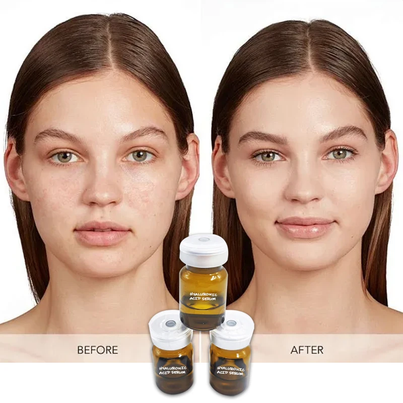 Repairing Peptide Brightening Whitening Lyophilized Powder Anti-aging ...