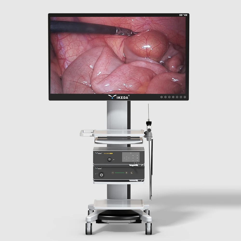 Ykd-9211 Surgical 4k Laparoscopic Endoscope Camera System Endoscopy ...