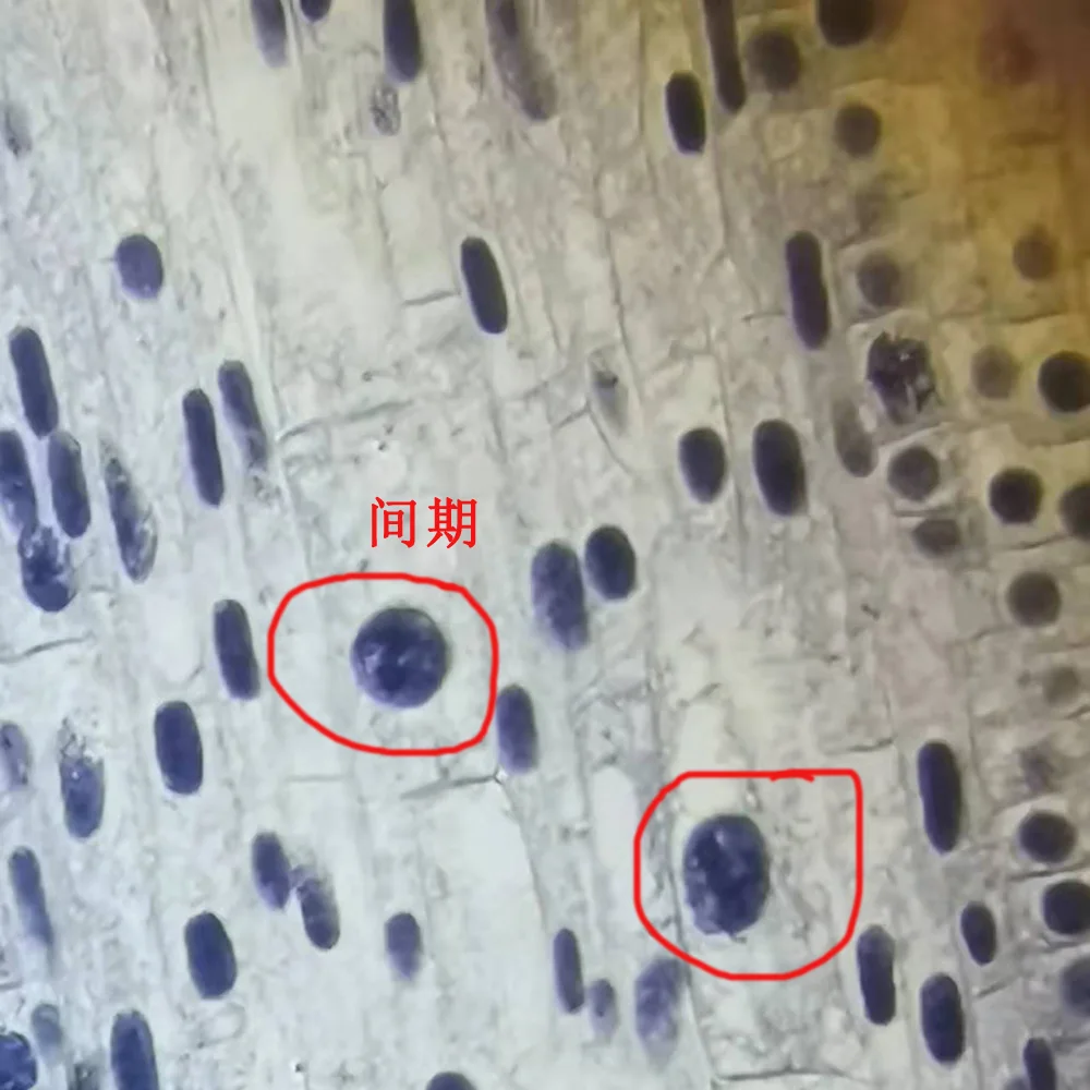 Onion Root Tip Mitosis Slides for Plant Cell Study - Clear Specimens ...