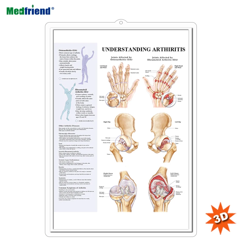 3D Medical Human Anatomical Wall Chart / Poster - Understanding ...